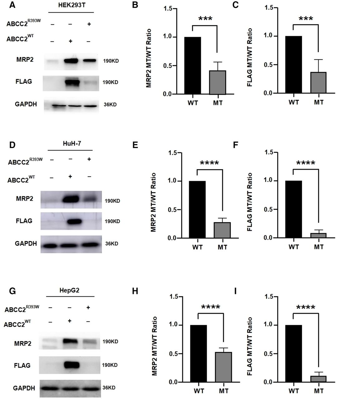 ABCC2 p.R393W variant contributes to Dubin-Johnson syndrome by ...