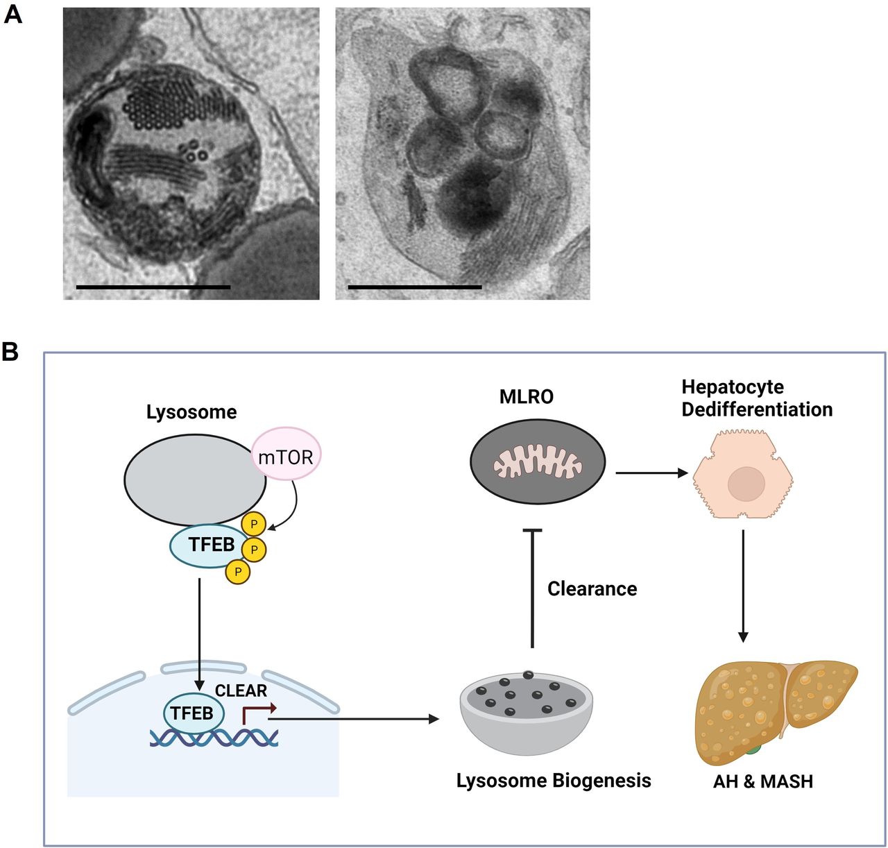Perspectives of mitochondria-lysosome-related organelle in hepatocyte dedifferentiation and ...