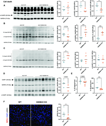 Gasdermin D deletion prevents liver injury and exacerbates extrahepatic ...