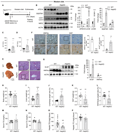 Autophagy related 14 protects against liver injury by inhibiting ...
