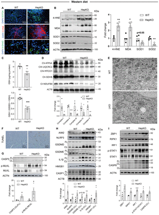 Autophagy related 14 protects against liver injury by inhibiting ...