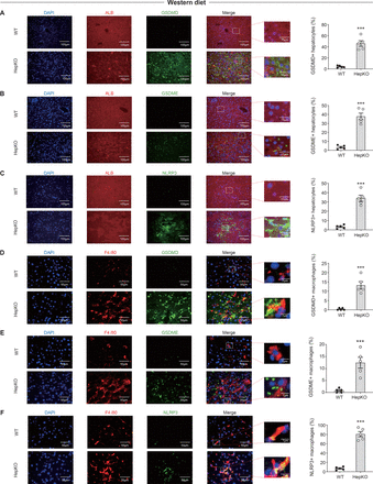 Autophagy related 14 protects against liver injury by inhibiting ...